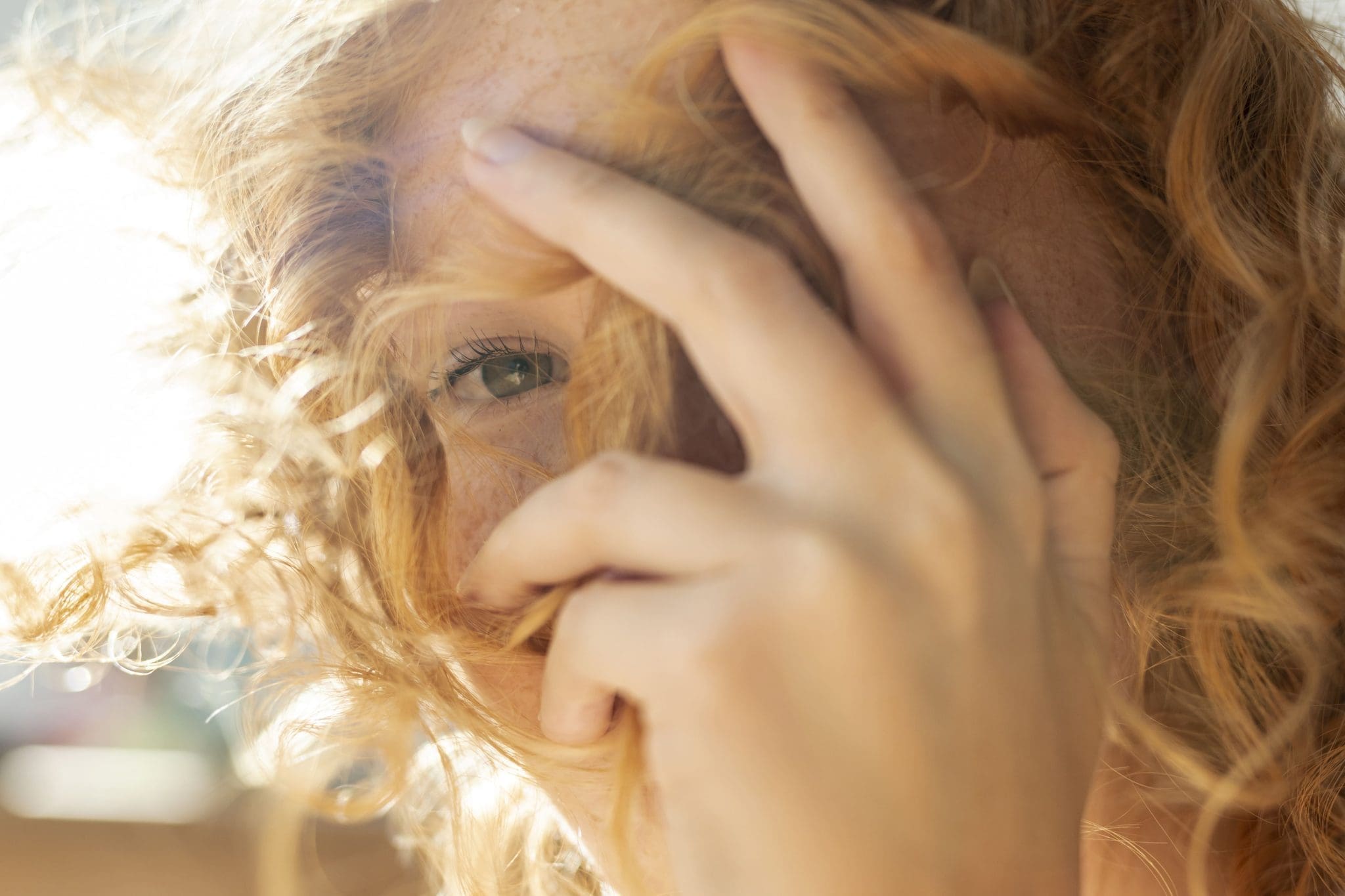 Alergia al sol: Síntomas, causas y tratamiento - MGC Mutua