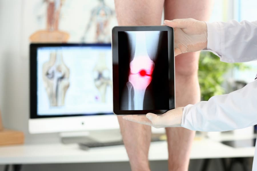 Tipos de prótesis de rodilla: ¿cuál es la mejor para ti?